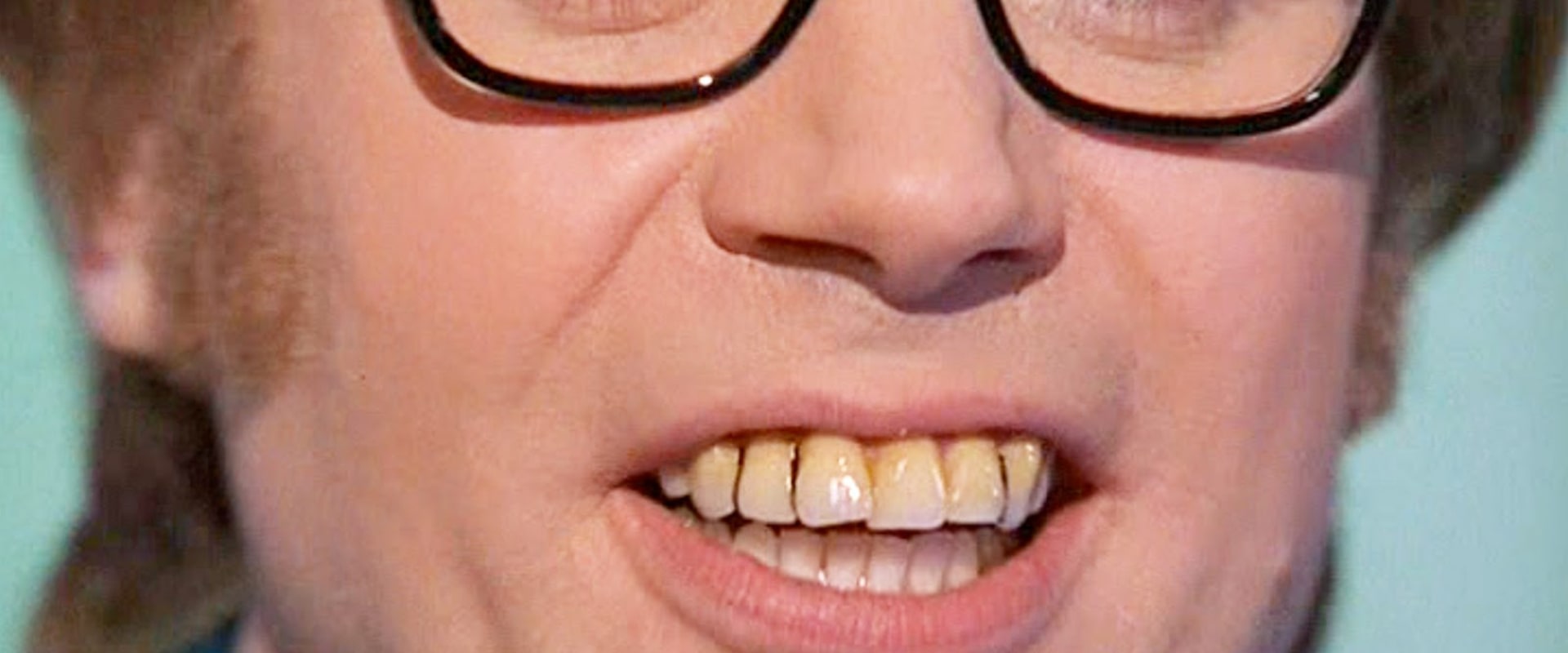 Are British Teeth Really Better than American Teeth?